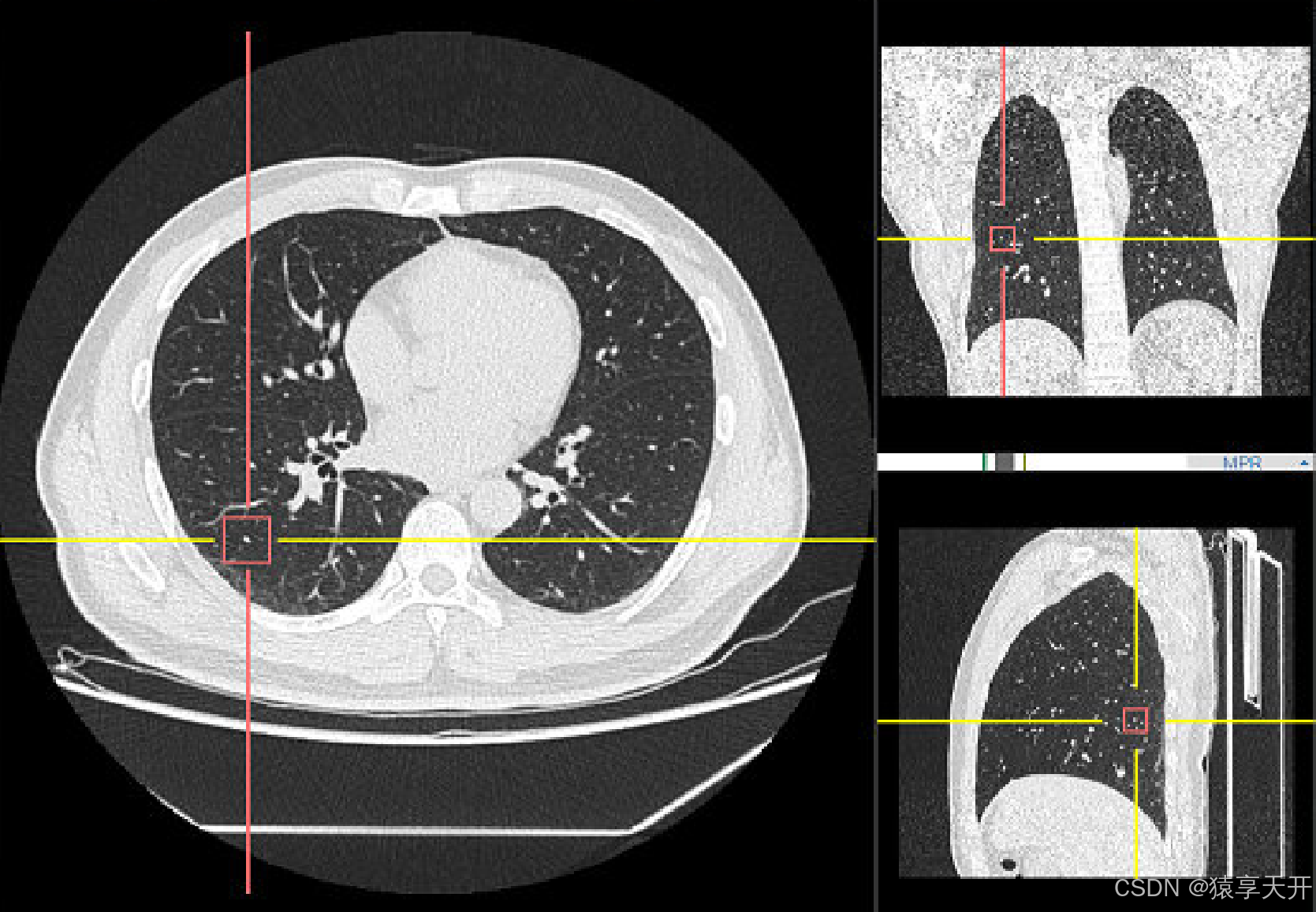 说说DICOM医学影像MPR重建技术应用的那些数学基础知识_DICOM医学影像专业知识精讲-CSDN专栏