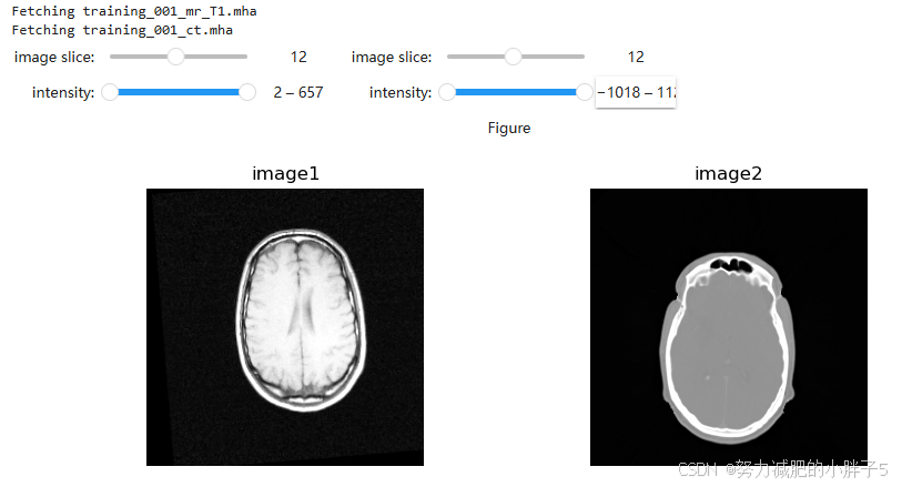 simpleITK - Setup - Results Visualization_simpleitk 合成荧光图像-CSDN博客