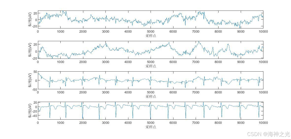 【胎心监护仪】基于matlab快速独立成分分析FastICA胎儿心跳信号噪声消除【含Matlab源码 11081期】-CSDN博客