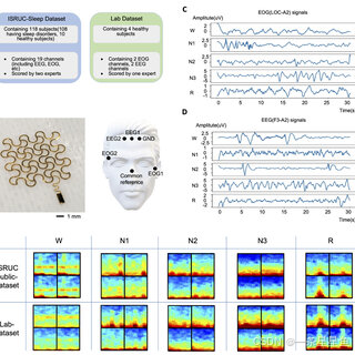 全网最全！当前最全公开可用的PSG（多导睡眠图）数据集_睡眠公开数据-CSDN博客
