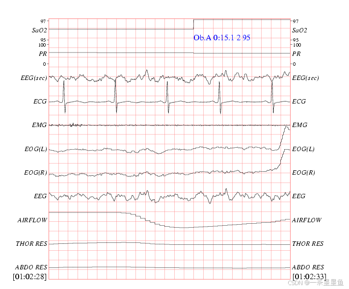 全网最全！当前最全公开可用的PSG（多导睡眠图）数据集_睡眠公开数据-CSDN博客