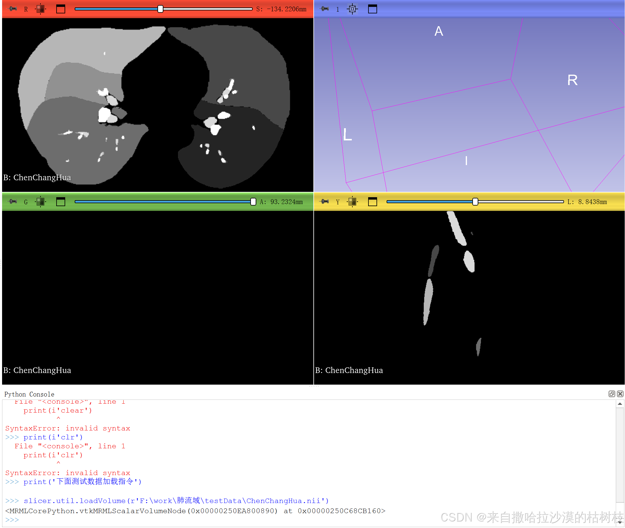 3d slicer python插件制作(二) slicer.util函数方法的试验-CSDN博客