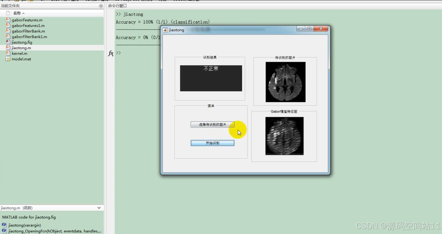 基于matlab的脑梗塞ct图像特征提取与识别系统设计（gabor+svm）_matlab的滤波算法对脑部ct的应用-CSDN博客