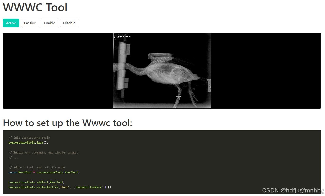 基于cornerstone.js的医学影像操作（巨详细）_cornerstonejs-CSDN博客