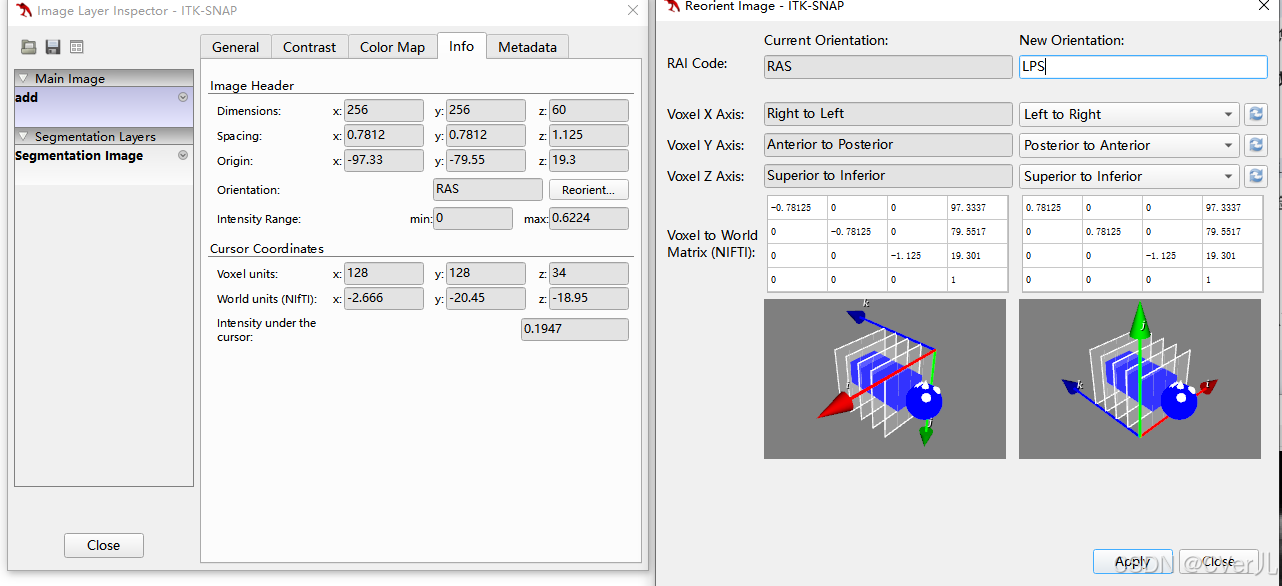 RAS 和 LPS 三维医学图像坐标方向_brainmri ras方向-CSDN博客
