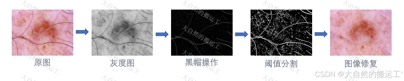 【图像预处理】图像毛发去除-超详细_cv2.findcontours 识别毛发-CSDN博客