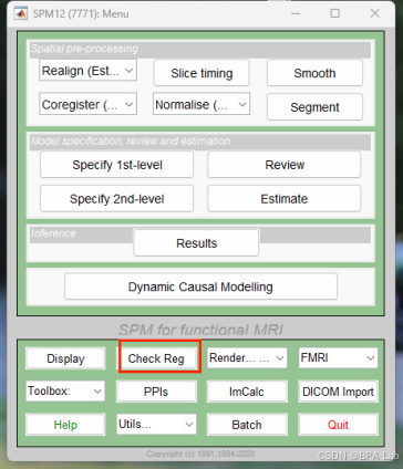 【入门且详细！fMRI信号预处理操作流程笔记】SPM12版_spm12入门教程-CSDN博客