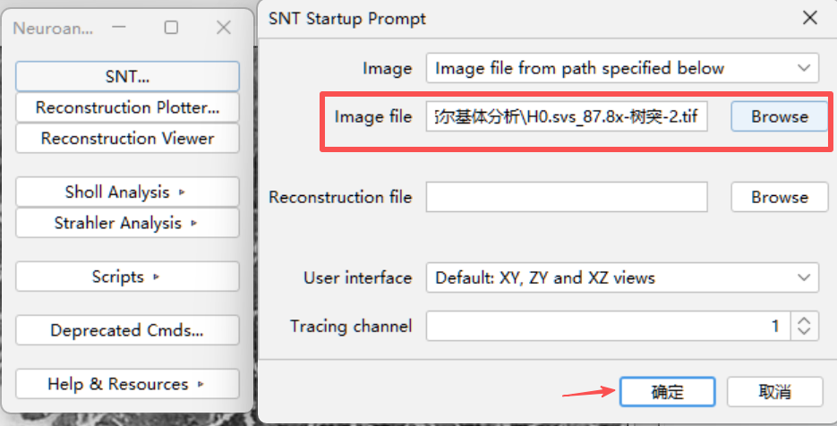 神经元高尔基染色Sholl分析(ing)-CSDN博客