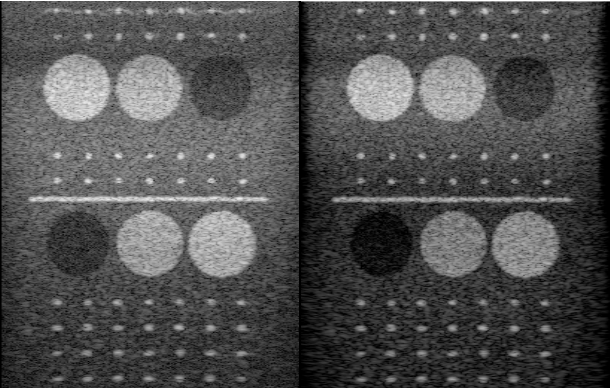 免费实时 超声软波束 框架 EchoSight-Pro发布页面_csdn echo sight-CSDN博客