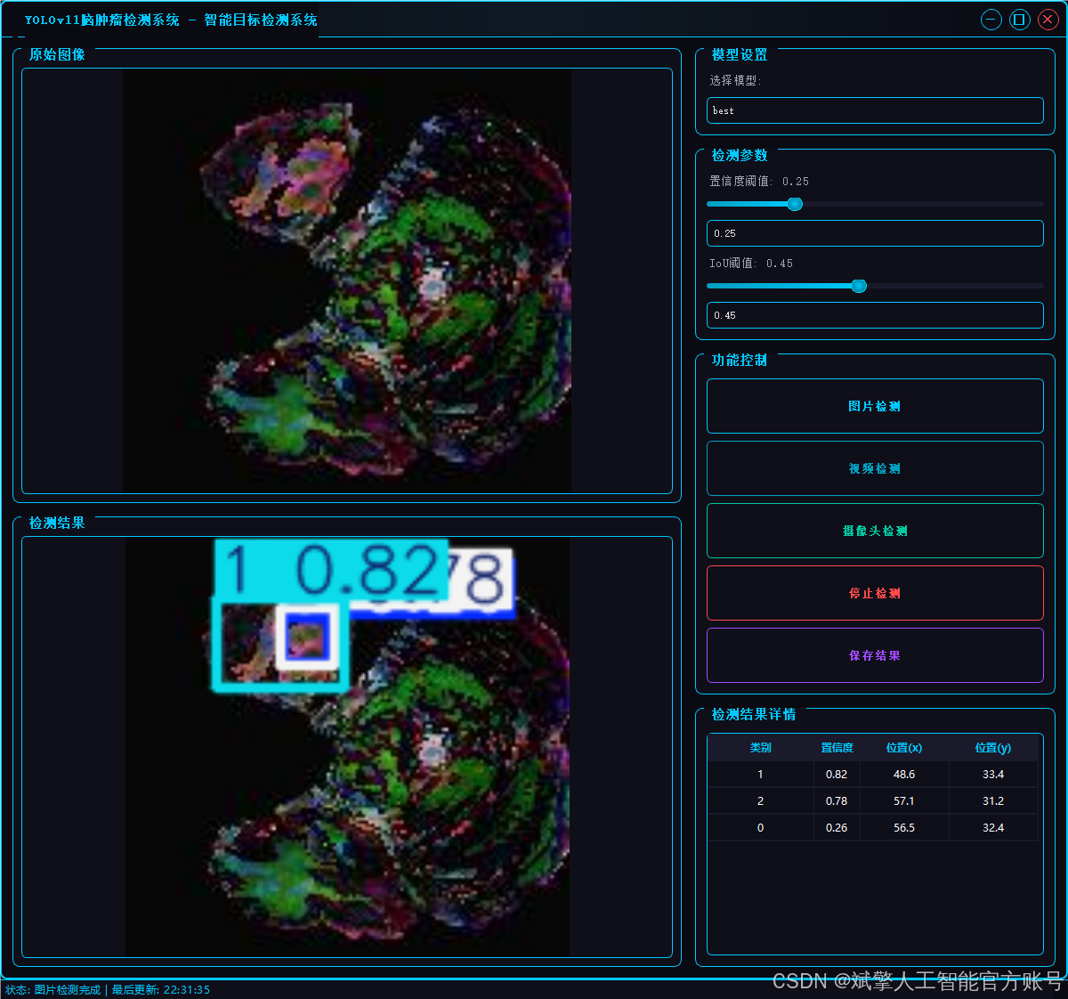 基于深度学习YOLOv11的脑肿瘤检测系统（YOLOv11+YOLO数据集+UI界面+登录注册界面+Python项目源码+模型）-CSDN博客