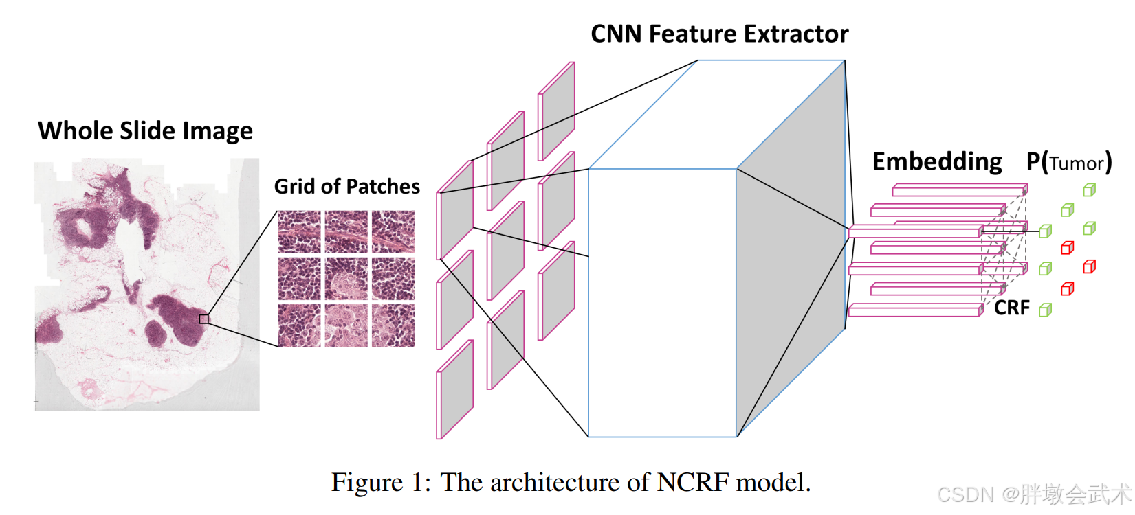 【PyTorch项目实战】乳腺癌检测：CNN补丁嵌入 + CRF空间建模-CSDN博客