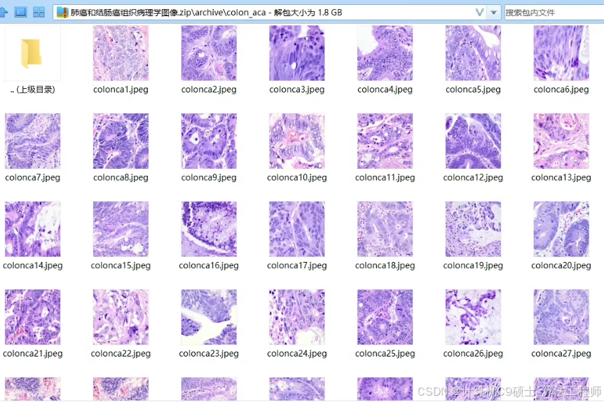 GitHub - QQ767172261/How-to-use-the-deep-learning-framework-PyTorch-for-lung-and-colon-cancer ...