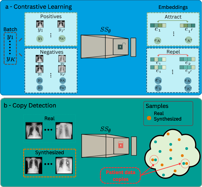 【Unconditional Latent Diffusion Models Memorize Patient Imaging Data】论文 ...