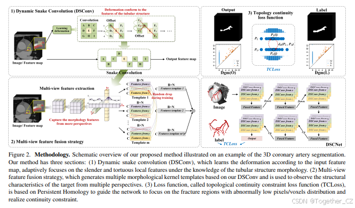 DSC：DSC on Topological Geometric Constraints forTubular Structure Segmentation—动态蛇形卷积基于拓扑几何约束的管状 ...