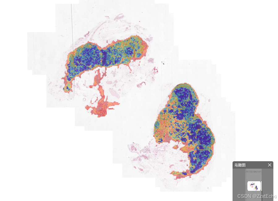 window系统复现CLAM，跑通700G-CAMELYON16_clam复现-CSDN博客