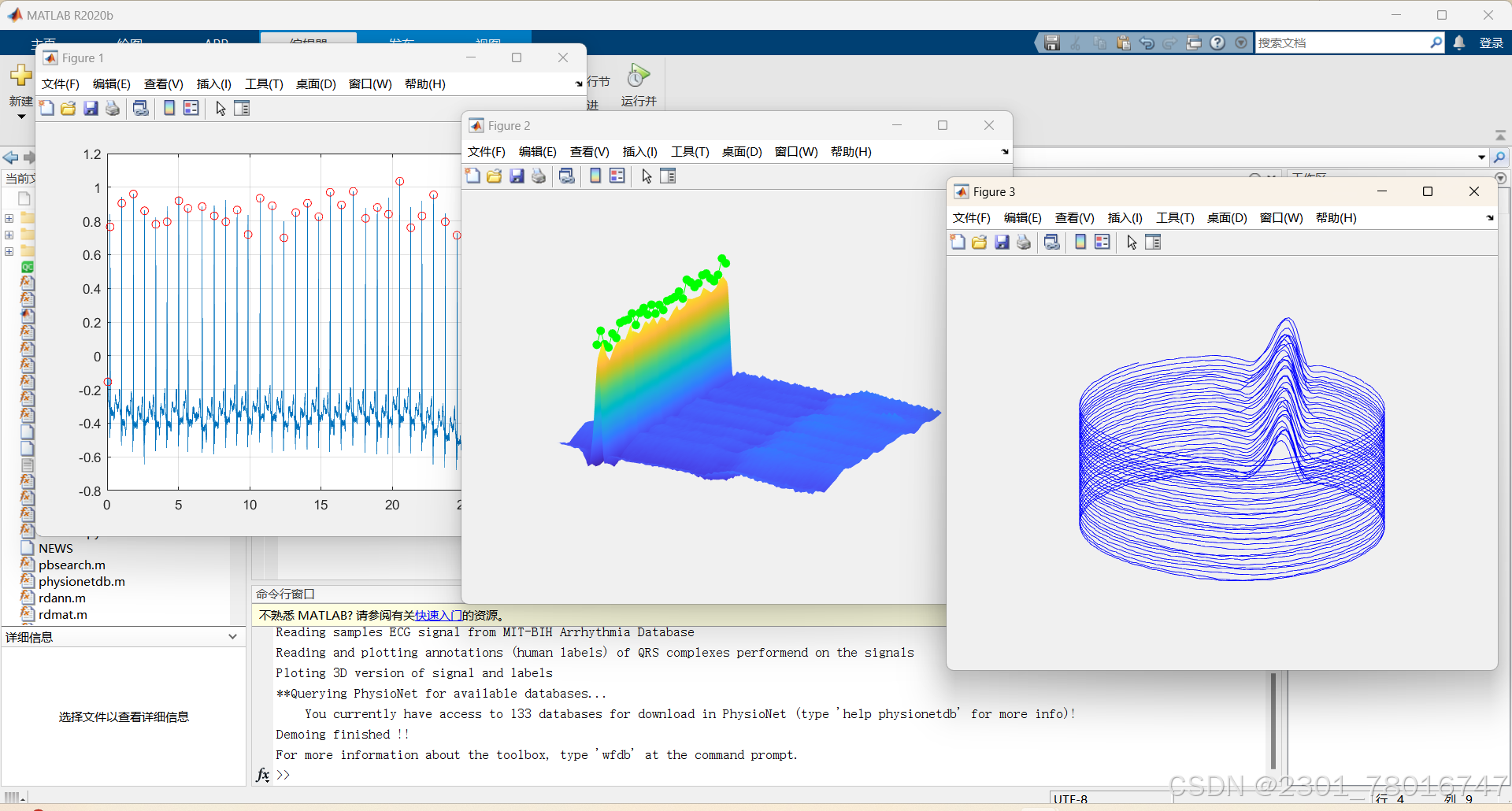 Matlab中wfdb库的安装的步骤_matlab安装wfdb-CSDN博客