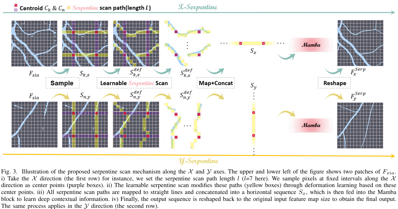 TMI 2025 | Serp-Mamba: Advancing High-Resolution Retinal Vessel Segmentation with Selective SSM ...