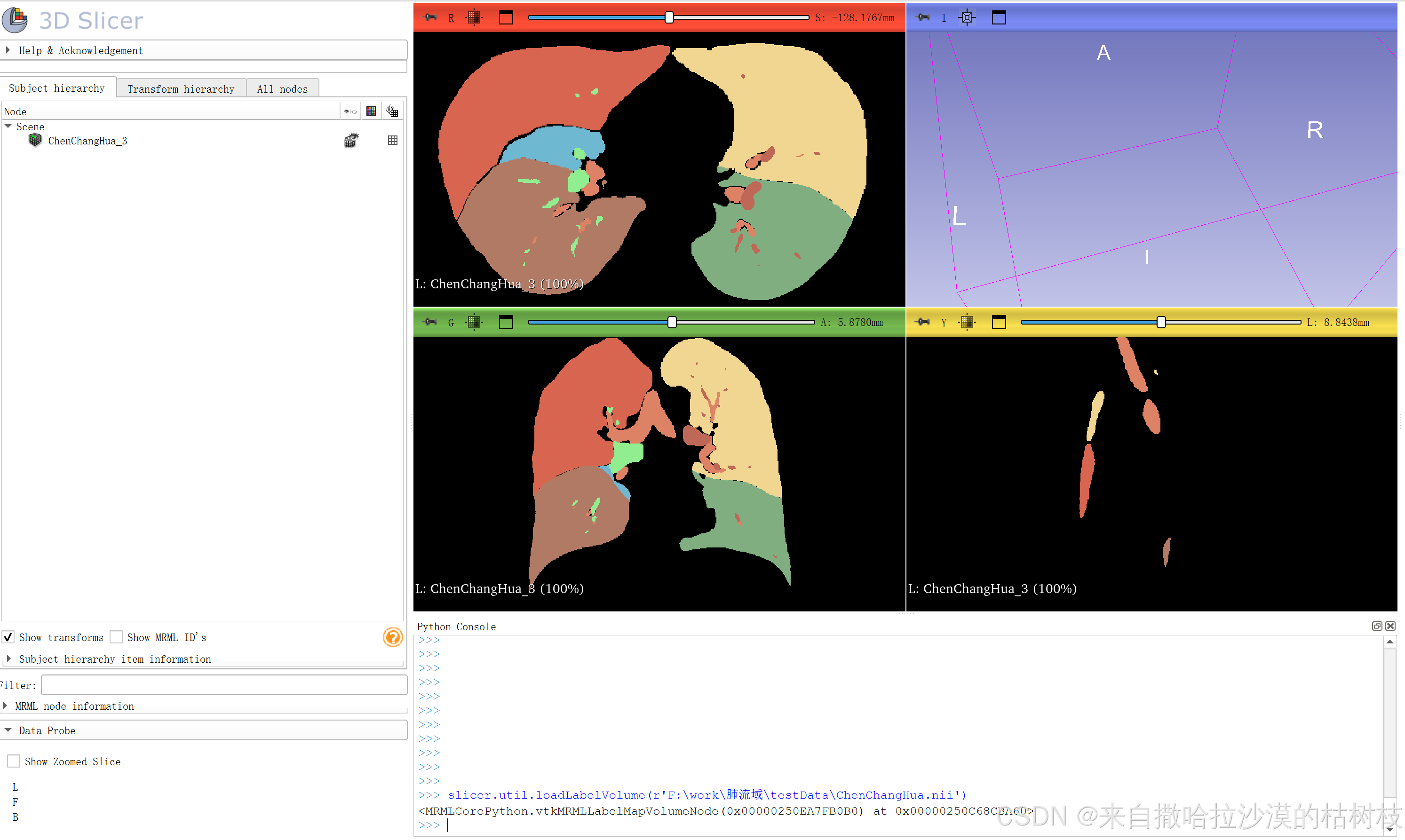 3d Slicer Python插件制作二 Slicerutil函数方法的试验 Csdn博客