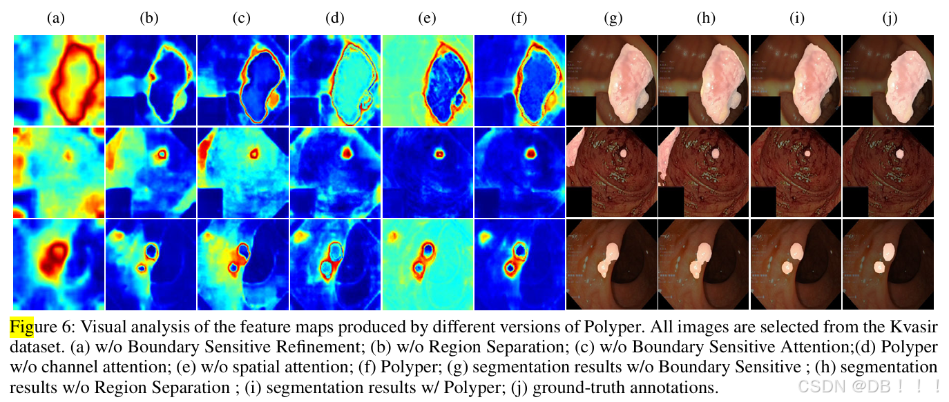 【结肠息肉AI论文集】Polyper:BoundarySensitivePolypSegmentation_polyper: boundary ...