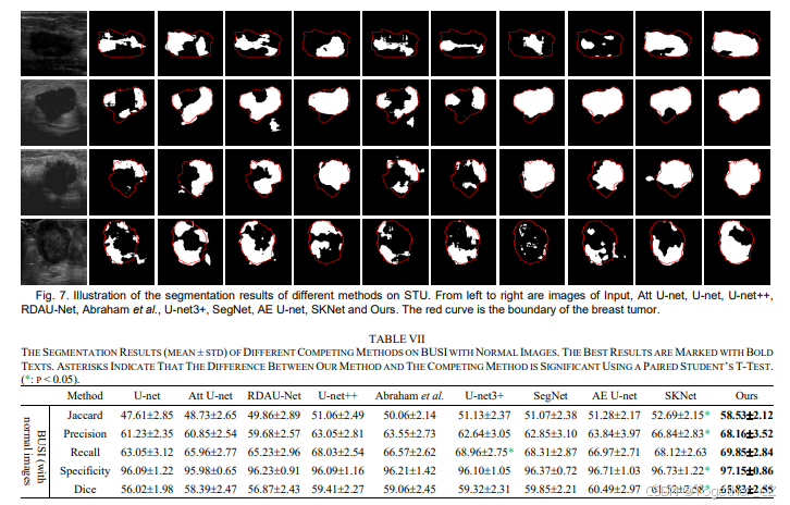 AAU-net:An Adaptive Attention U-net for BreastLesions Segmentation in Ultrasound Images用于超声图像中乳腺 ...