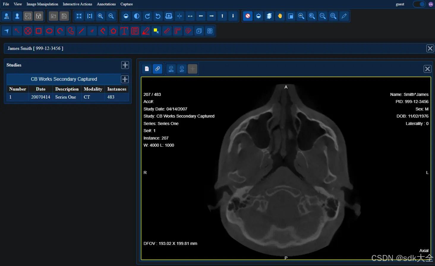 LEADTOOLS 23.x Medical Viewer SDK Libraries_leadtools medical-CSDN博客