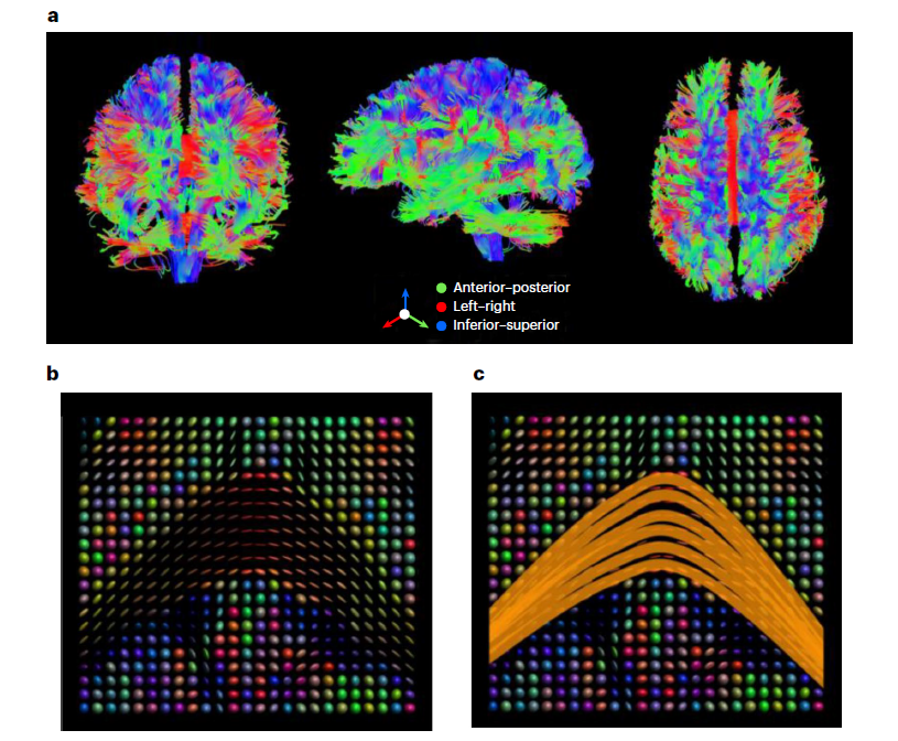 扩散 MRI 与结构连接组学：从原理到应用_概率性纤维追踪odf-CSDN博客