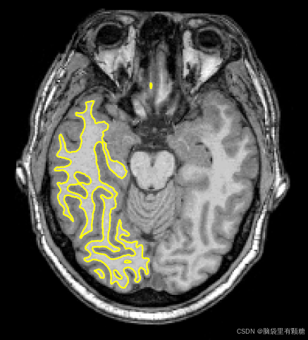 Workbench View 可视化(FreeSurfer2Workbench)问题小结_freesurfer 可视化-CSDN博客
