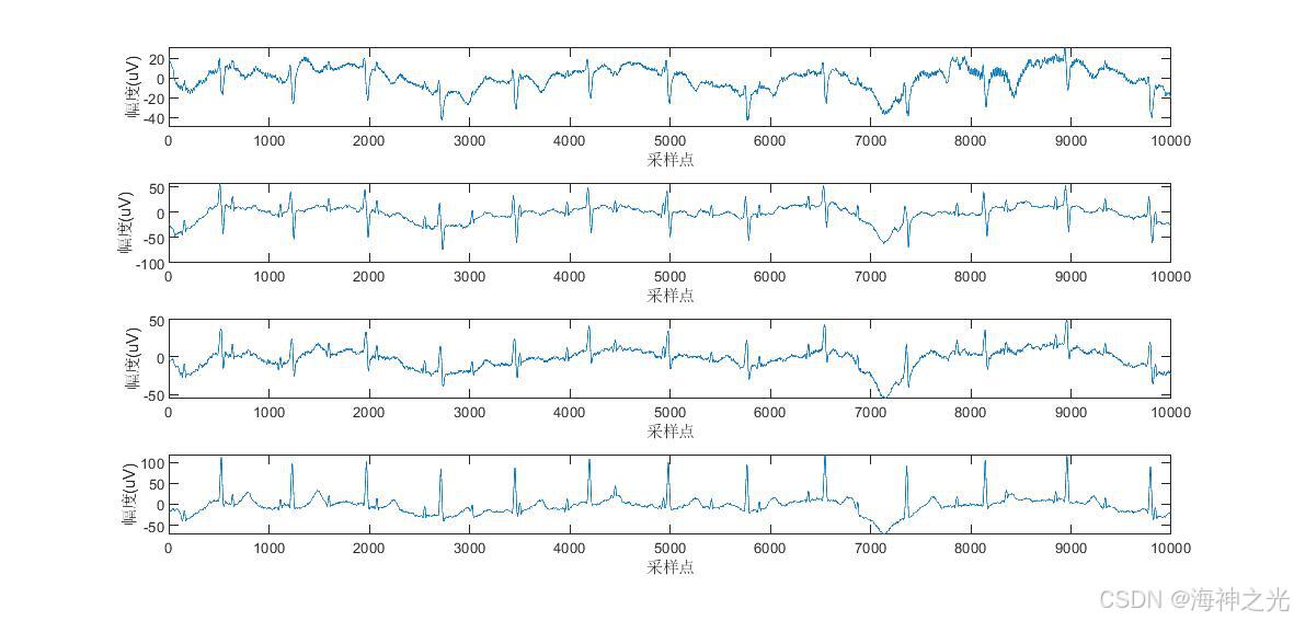 【胎心监护仪】基于matlab快速独立成分分析FastICA胎儿心跳信号噪声消除【含Matlab源码 11081期】_Matlab信号处理 （进阶版）-CSDN专栏