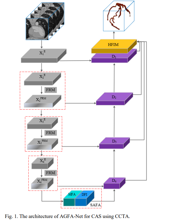 AGFA-Net：一种基于注意力机制和特征聚合的冠状动脉分割网络，用于计算机断层扫描血管造影图像分析-CSDN博客