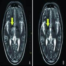 MRI k空间概念整理-CSDN博客