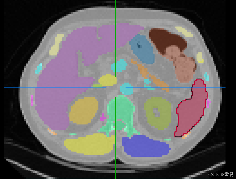 TotalSegmentator---针对CT/MRI数据的自动分割_totalsegmentator python版本-CSDN博客