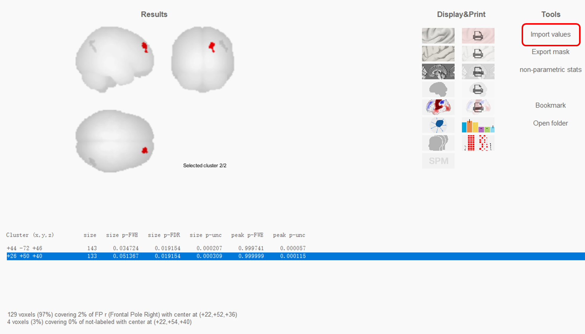 MRI学习笔记-gPPI-CSDN博客