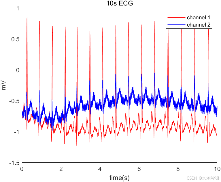 信号与系统工程实践--ECG（心电图）_ecg信号-CSDN博客