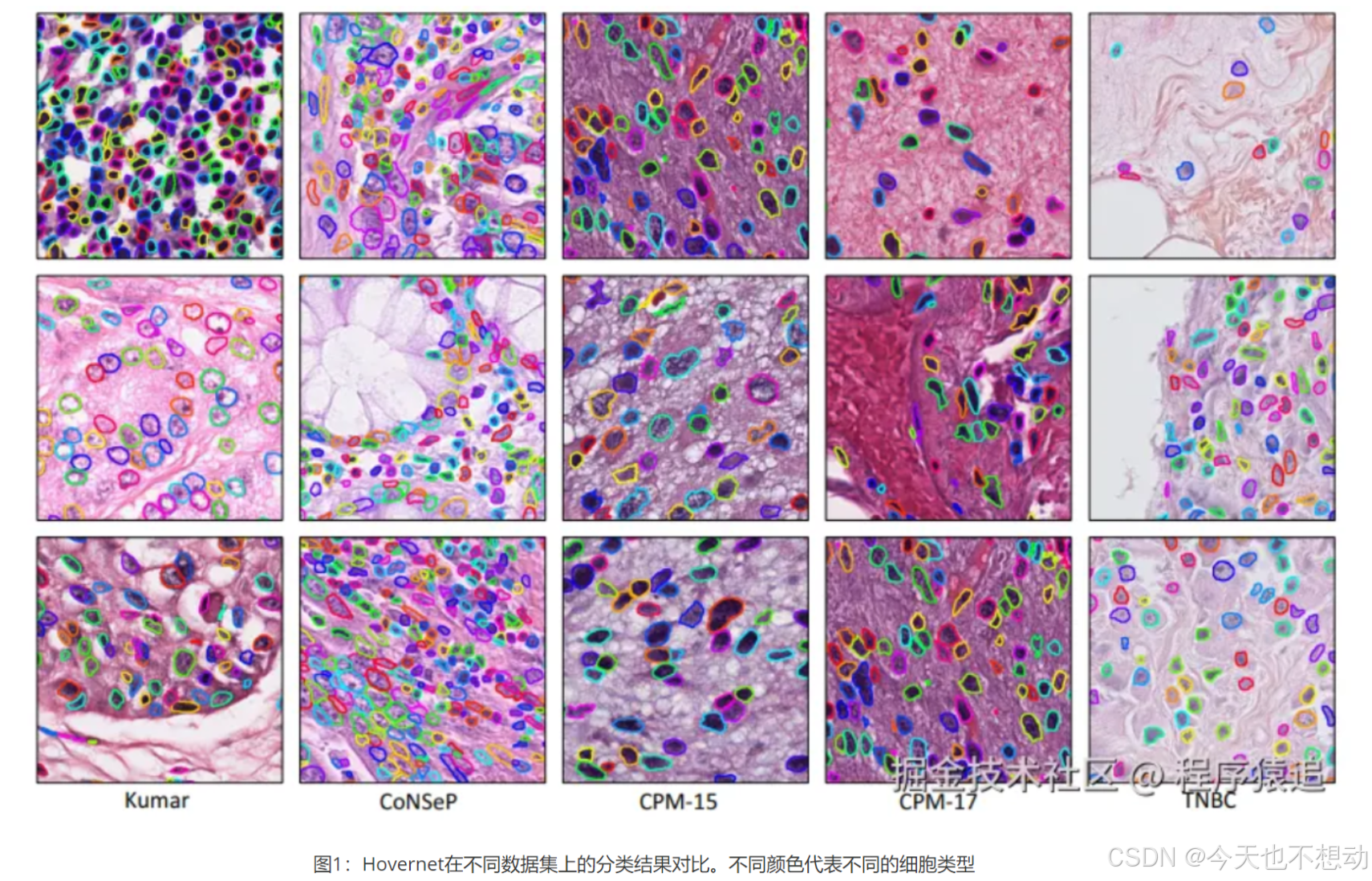 HoVer-Net_实操与文章应用思路_hovernet-CSDN博客