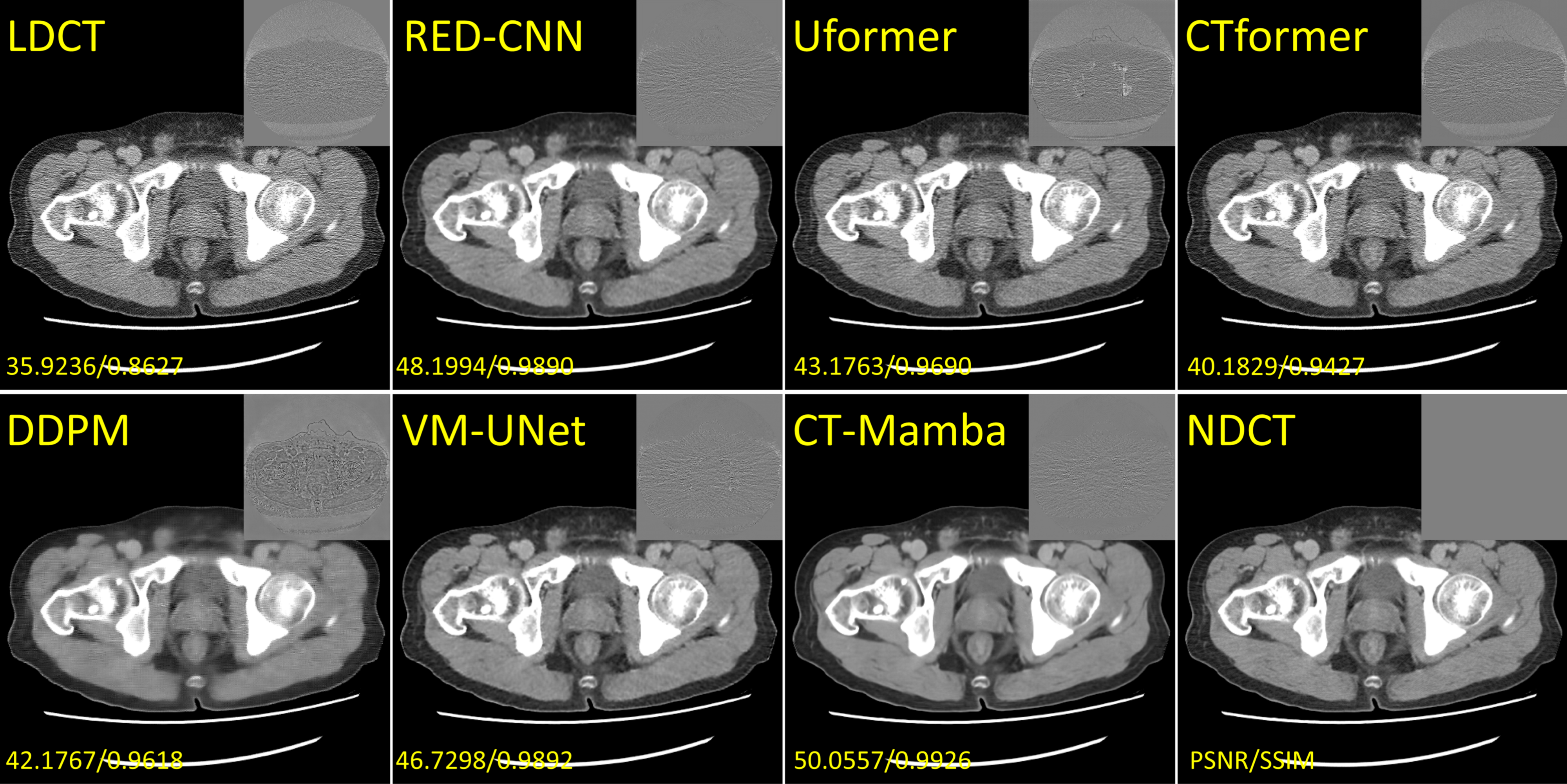 CT-Mamba：低剂量CT降噪的混合卷积状态空间模型详解_低剂量ct去噪 mamba-CSDN博客