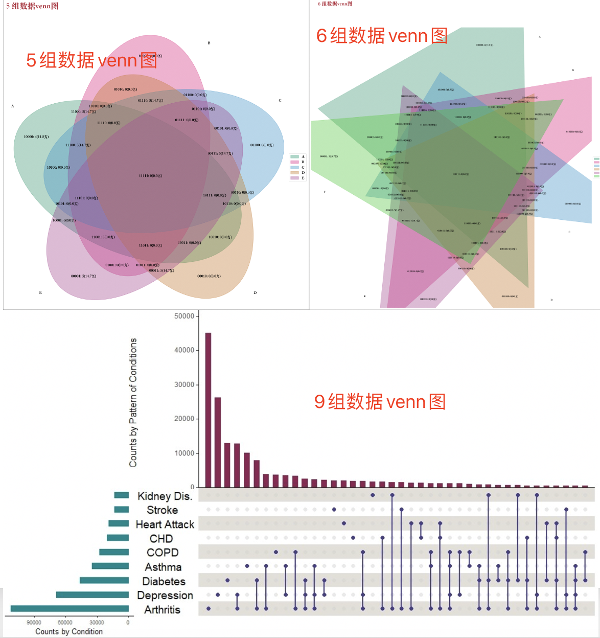 CNS必备UpSet图，这样画，这样看！-CSDN博客