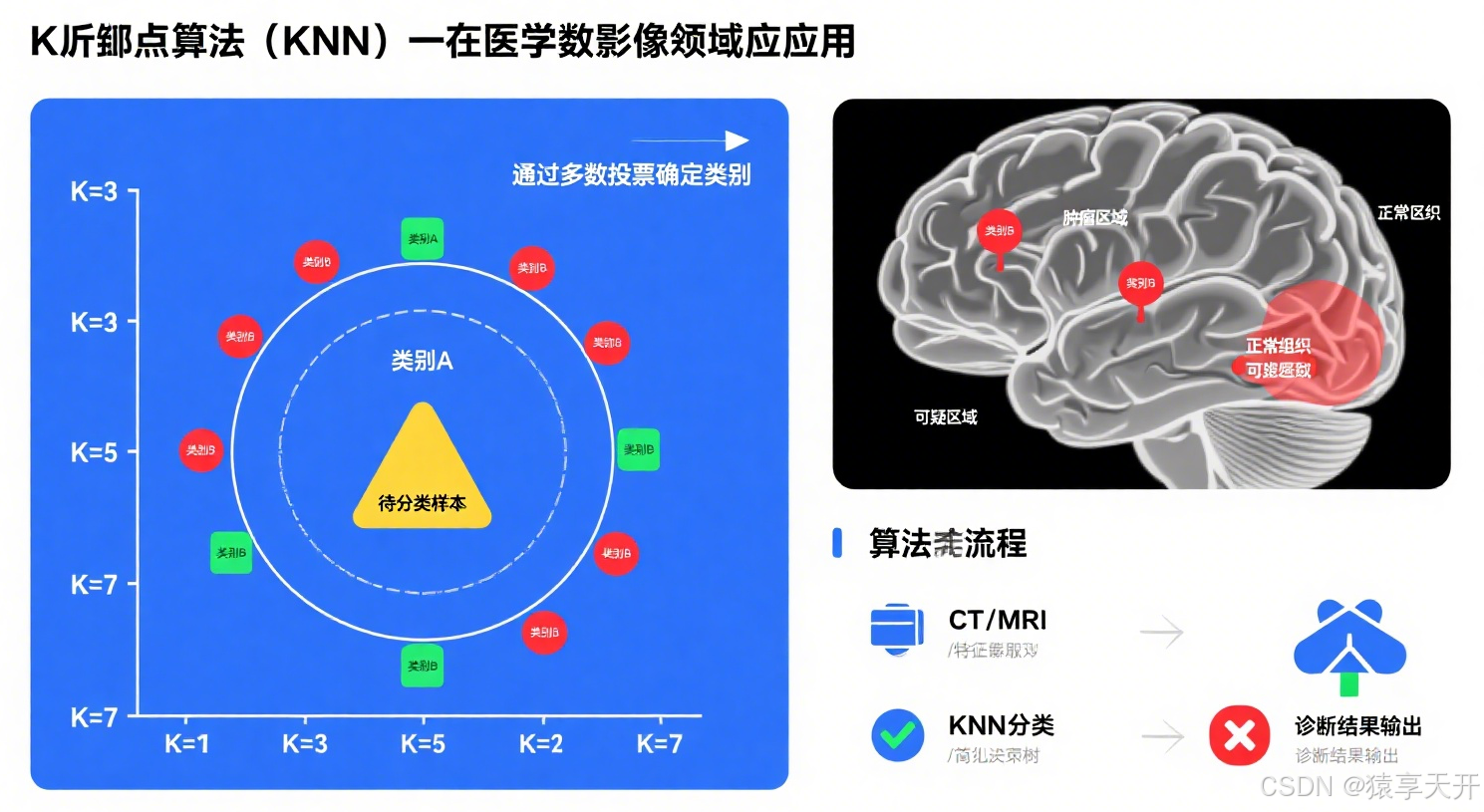 深入详解K近邻算法（KNN）：基本概念、原理及在医学影像领域的应用与实现-CSDN博客