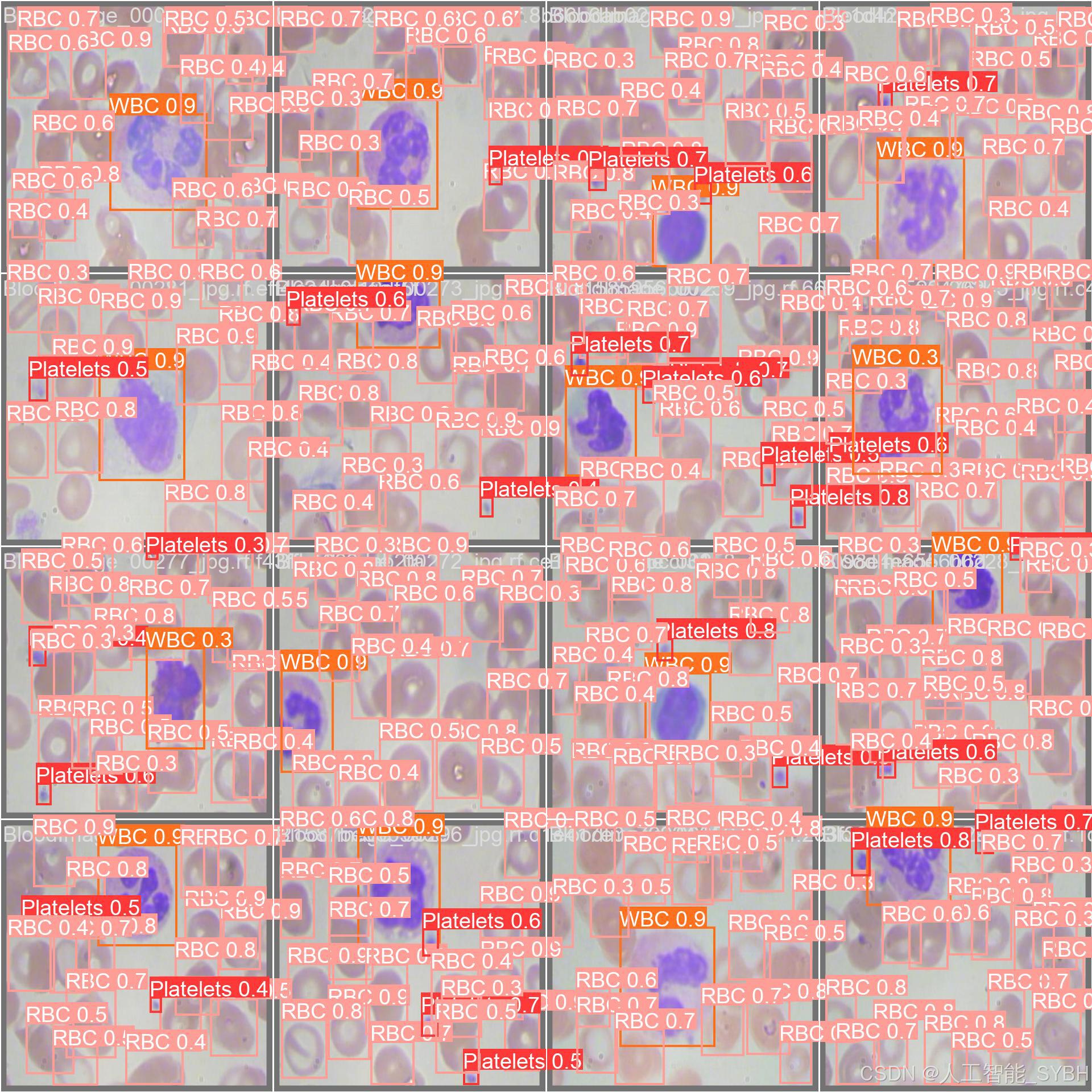 基于深度学习YOLOv10的红细胞、白细胞和血小板检测系统（YOLOv10+YOLO数据集+UI界面+Python项目源码+模型）-CSDN博客