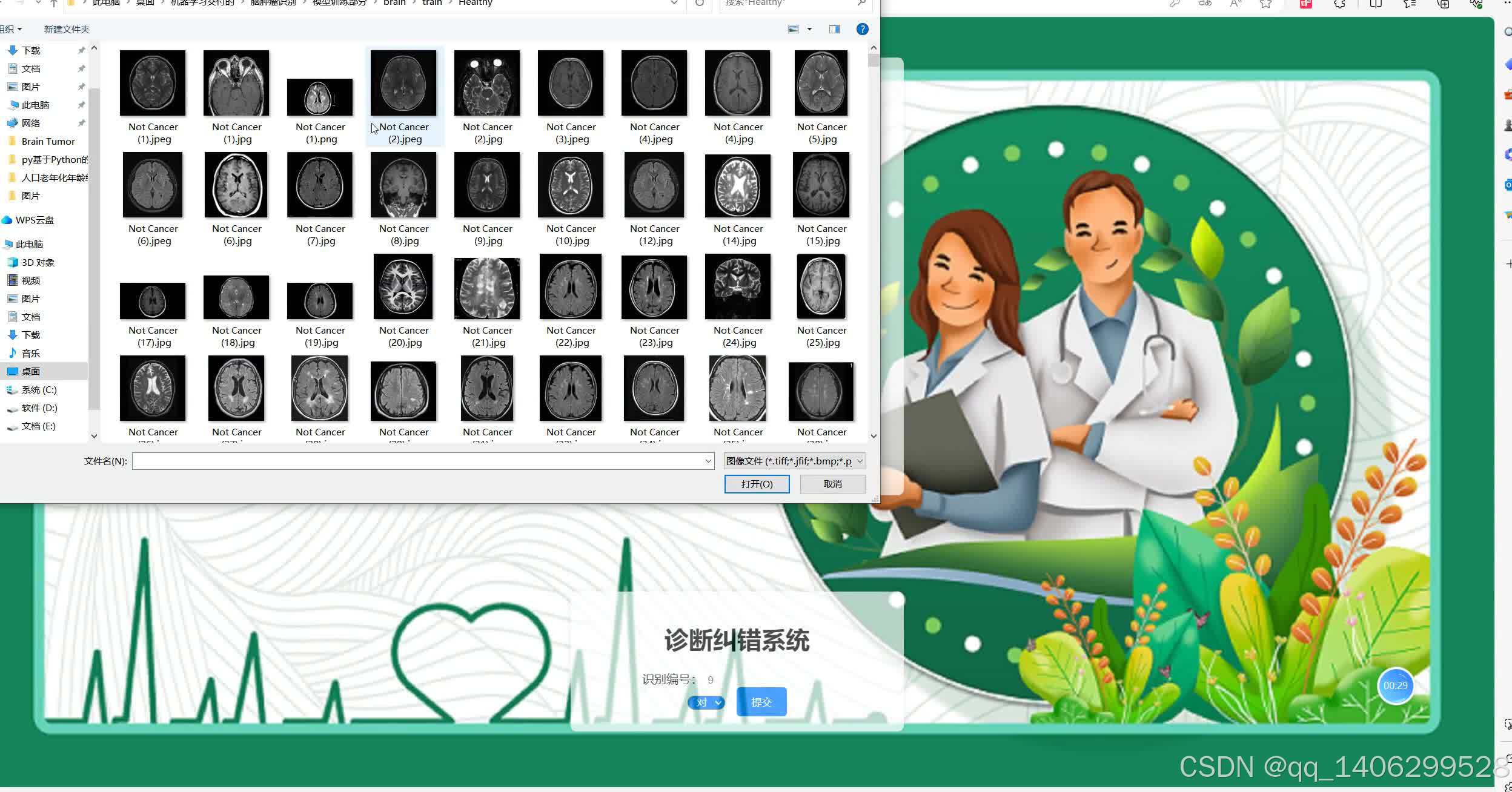 python基于深度学习的医学图像诊断系统_python_qq_1406299528-讯飞AI开发者社区