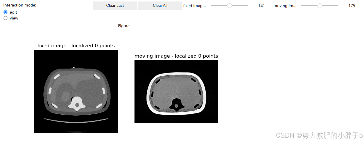 simpleITK - Registration - SimpleITKv4配准 初始化_simpleitk.smoothingrecursivegaussian-CSDN博客