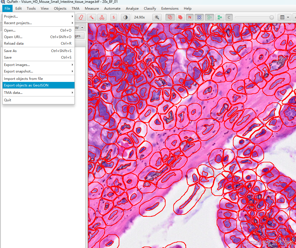 Visium HD使用Cellpose进行细胞分割-补充_cellpose3进行细胞分割后,从细胞核向外扩展的合理范围-CSDN博客