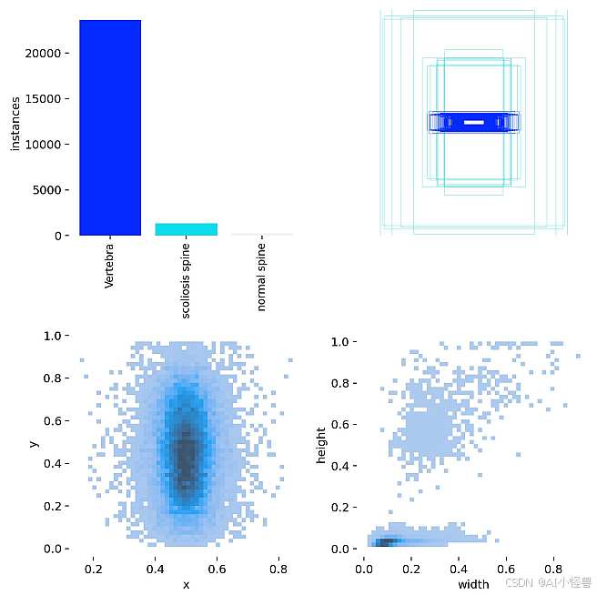 基于YOLO11的脊柱侧弯X射线检测系统（Python源码+数据集+Pyside6界面）_yolov11-pose 判断脊柱侧弯-CSDN博客