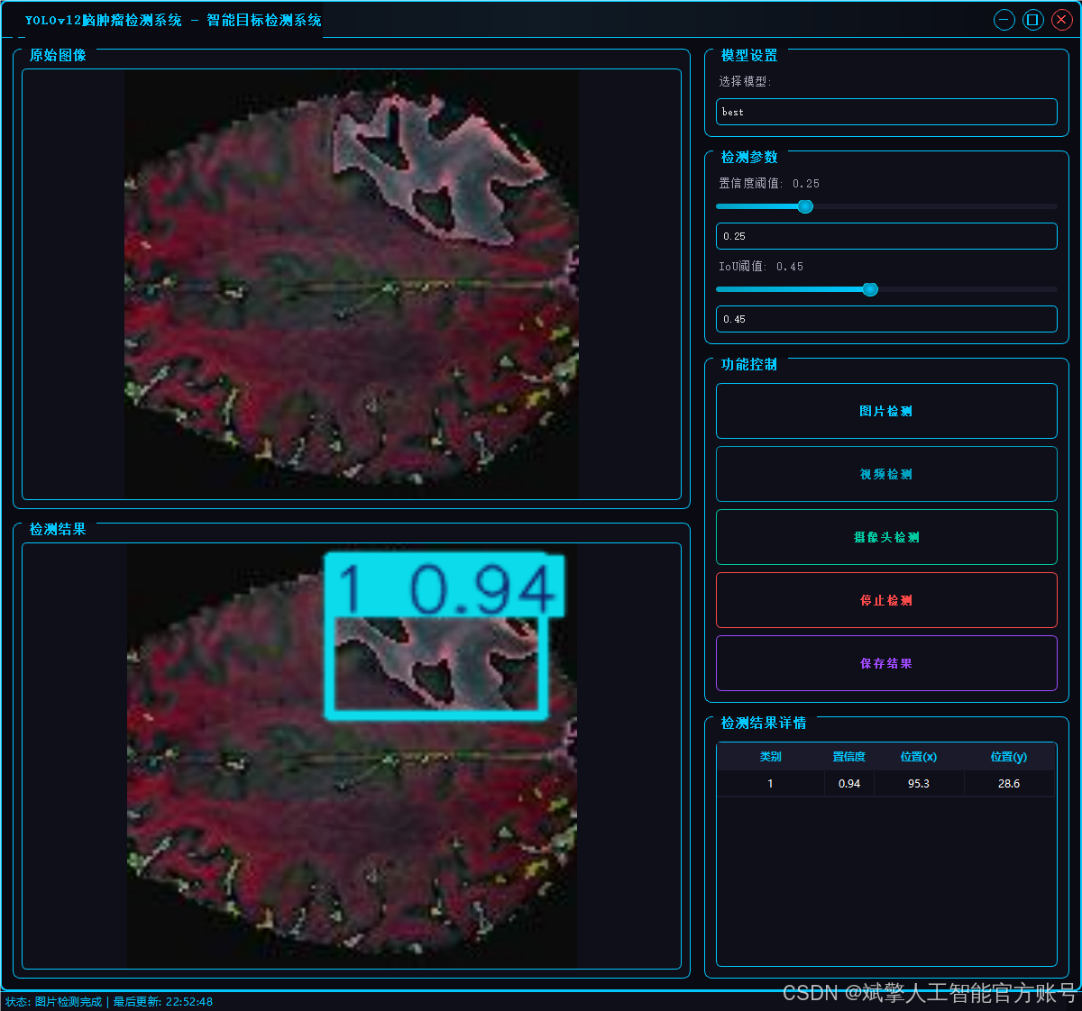 基于深度学习YOLOv12的脑肿瘤识别检测系统（YOLOv12+YOLO数据集+UI界面+登录注册界面+Python项目源码+模型）-CSDN博客