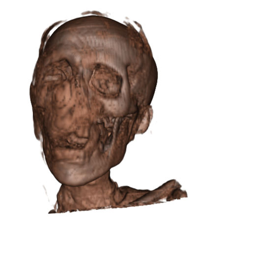 VTK知识学习（48）- 体绘制（三）vtkVolume-CSDN博客