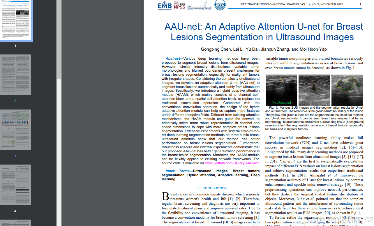 AAU-net:An Adaptive Attention U-net for BreastLesions Segmentation in Ultrasound Images用于超声图像中乳腺 ...
