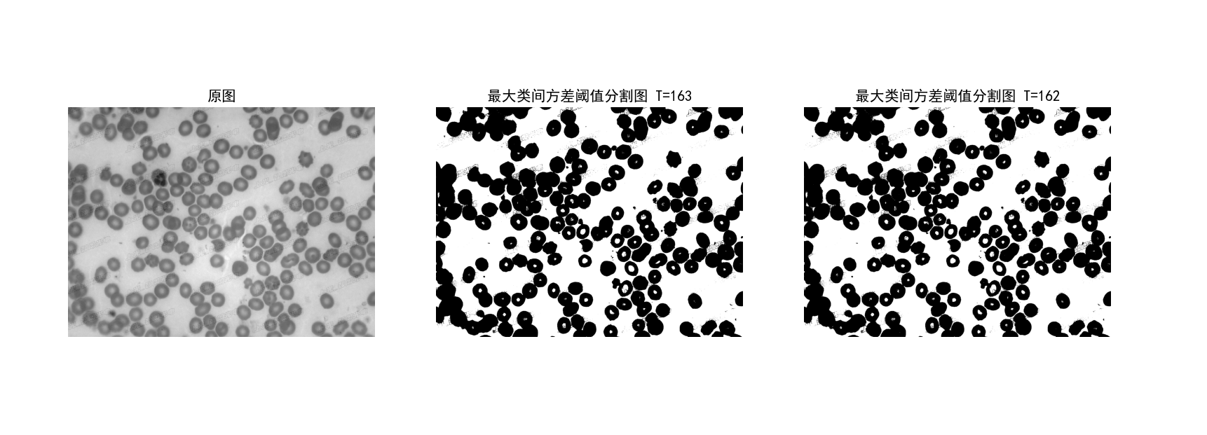 DIP——Lab_05-CSDN博客