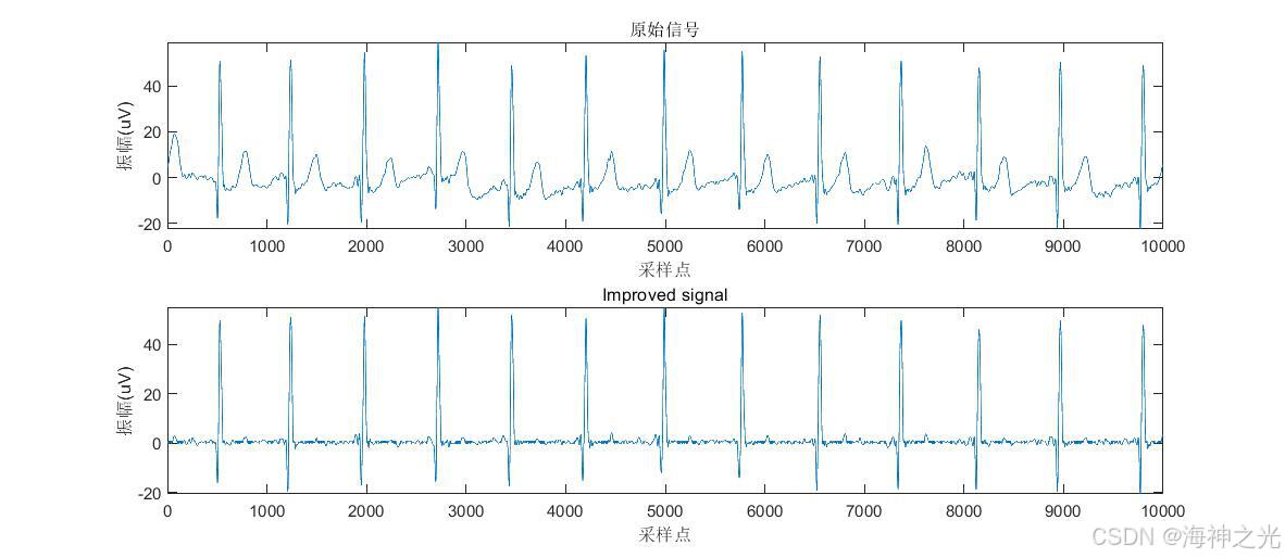 【胎心率监测器】基于matlab FastICA胎儿心跳信号噪声消除【含Matlab源码 9973期】-CSDN博客