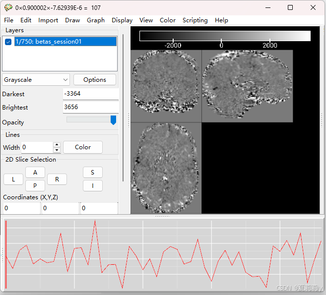 [代码实战]从0开始实现fMRI字幕预测和视觉问答_nsd数据集-CSDN博客