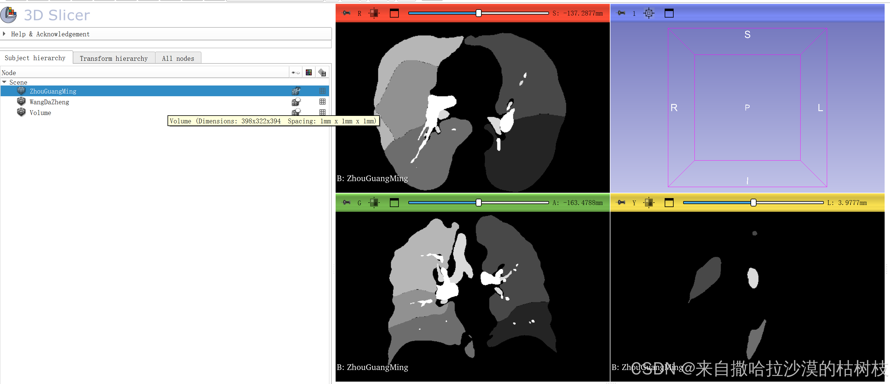 3d Slicer Python插件制作二 Slicerutil函数方法的试验 Csdn博客