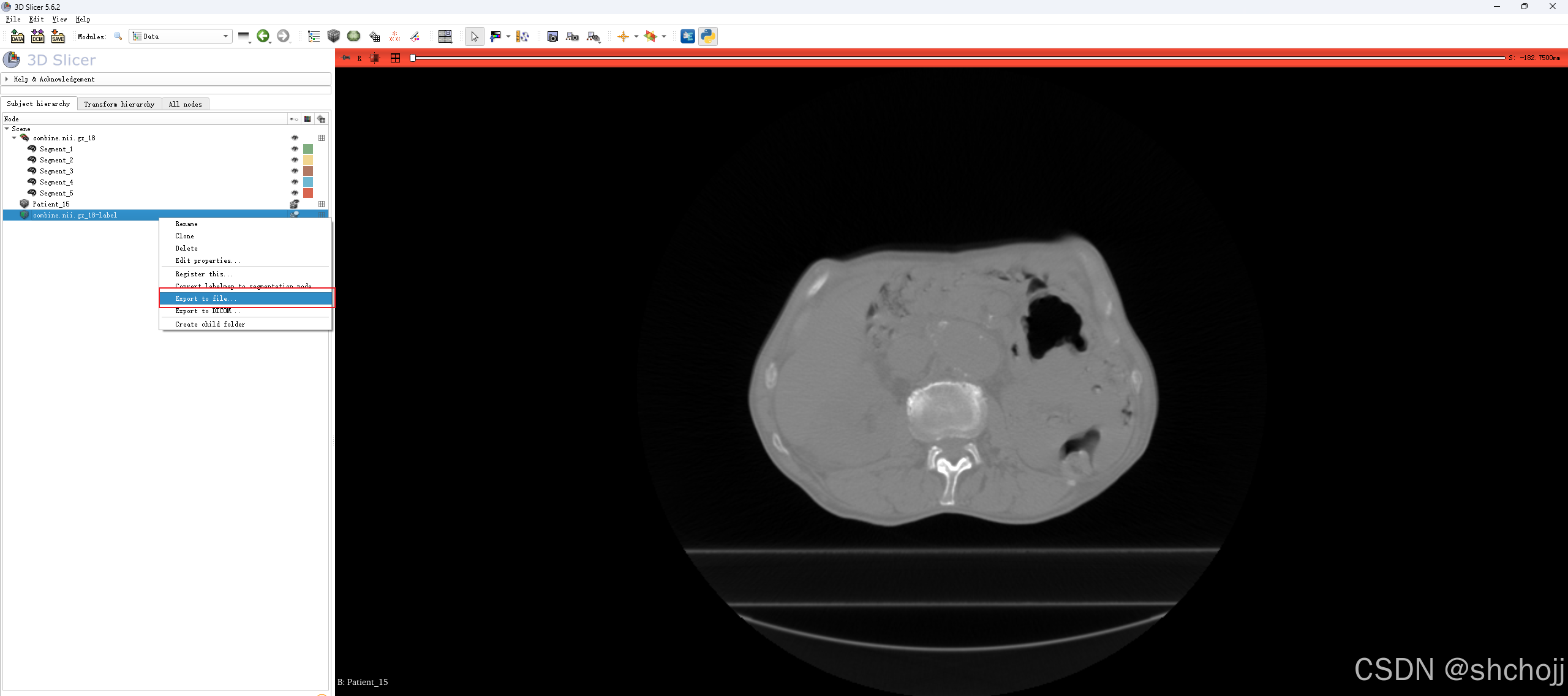 借助3D slicer 修改mask_3d slice 对mask修改灰度值-CSDN博客